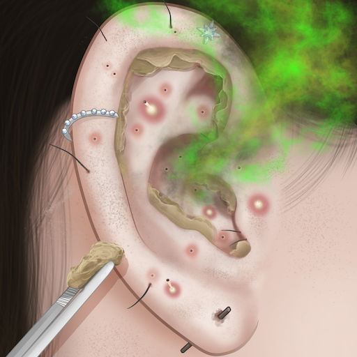 Ear Cleaning Master Latest Version for Android/iOS - TapTap