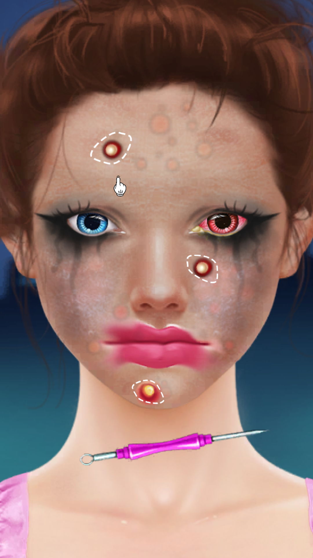 Pimple Clinic! ASMR makeover android iOS apk download for free-TapTap